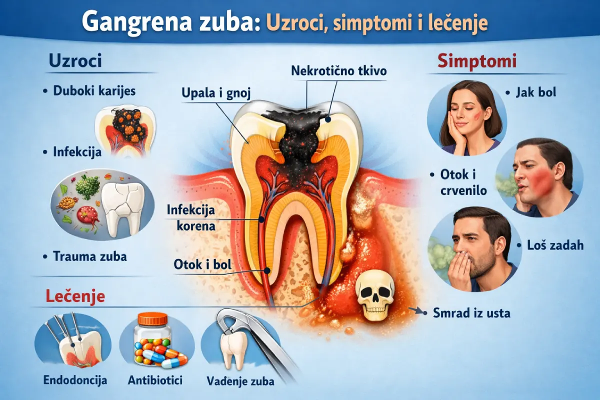 Gangrena zuba: uzroci, simptomi i lečenje - Zubar Beograd