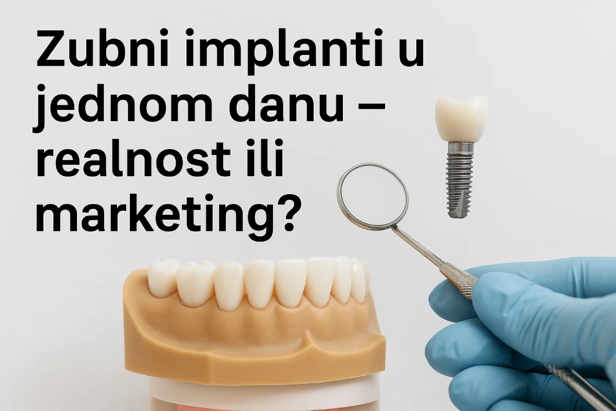 Zubni implanti u jednom danu – realnost ili marketing? - Zubar Beograd